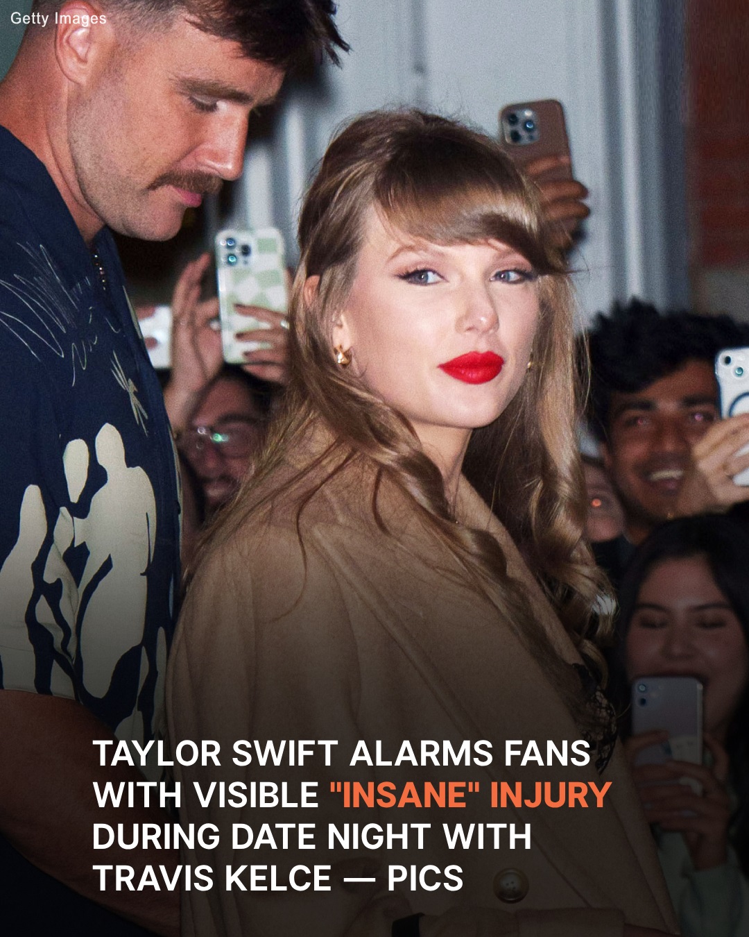 Taylor Swift Sparks Concern over 'Insane' Burn on Her Arm during Date ...