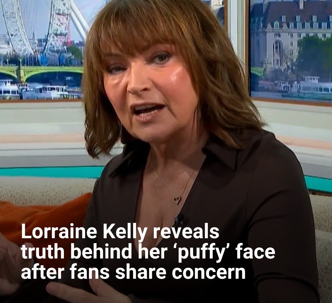 Lorraine Kelly reveals truth behind ‘puffy’ face after fans share ...